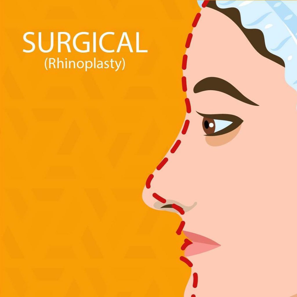 Surgical, Liquid, Or Lunchtime Nose Job: What The Doctors Say - Beverly ...