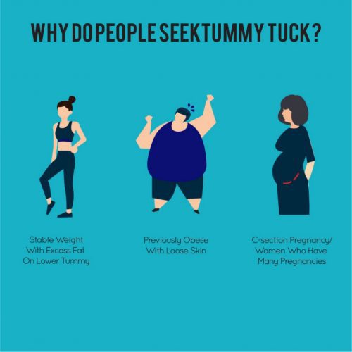 Tummy Tuck: Get Rid Of Spare Tire - Beverly Wilshire Medical